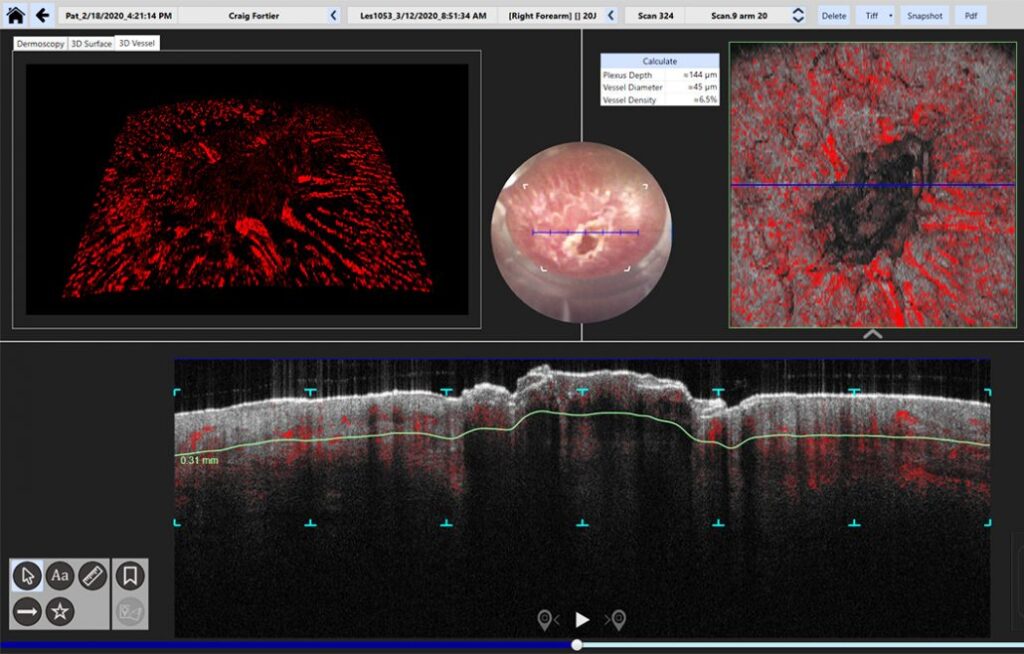Begleitprodukte – VivoSight